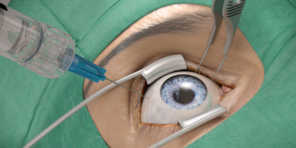 Neue Augen-Spezialambulanz im Salzkammergut Klinikum Gmunden - salzi.at